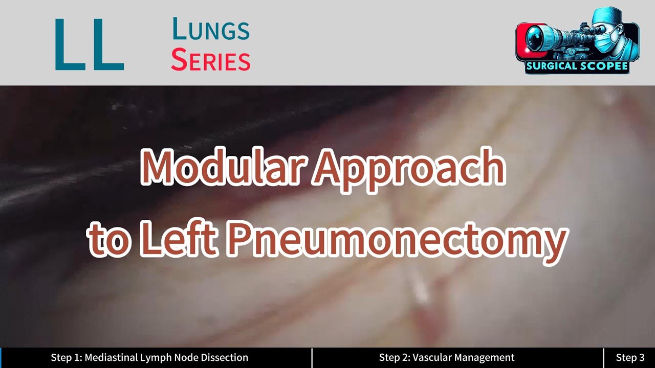 modular-approach-to-left-pneumonectomy-a-case-study-youtube