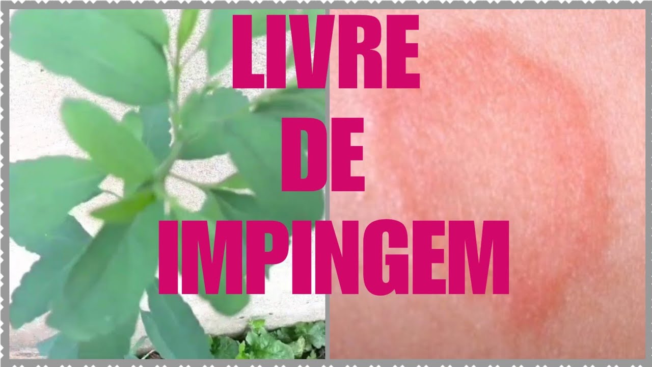 Como Curar Impinge Com Vinagre - RETOEDU