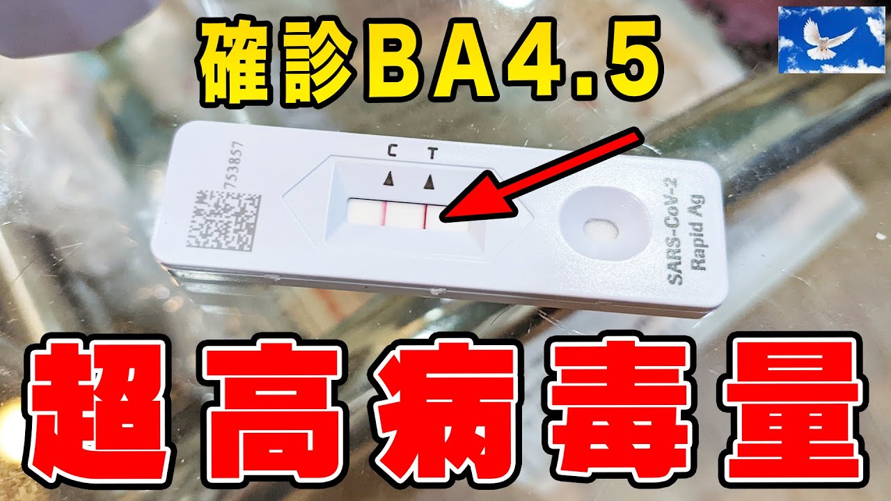 確診了...終究還是逃不過。BA5症狀有多可怕? | 蒼藍鴿聊醫學EP238 - YouTube