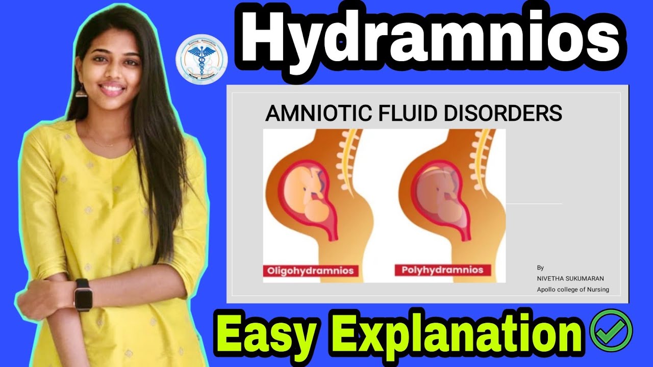 Hydramnios | Gynecology | Nursing Lecture | Easy Explanation | Nursing ...