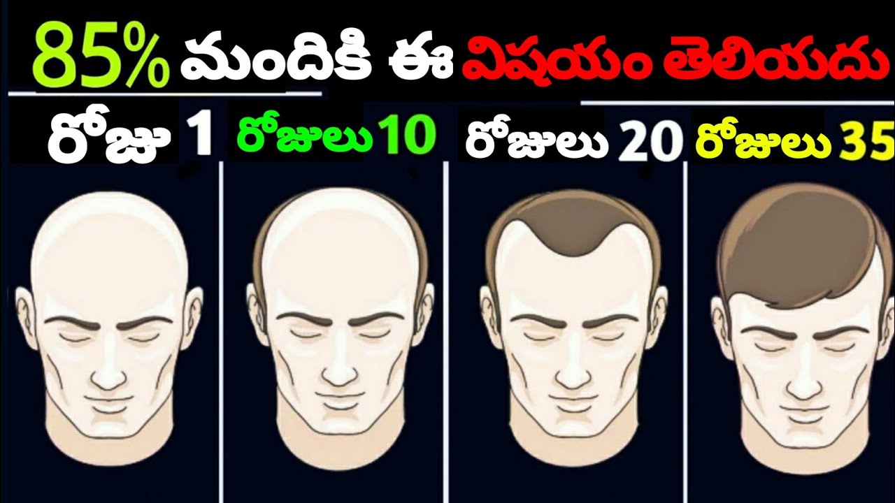 20 వయస్సు MUST WATCH 🔥|| NATURAL HAIR GROWTH TIPS || Time For Greatness ...