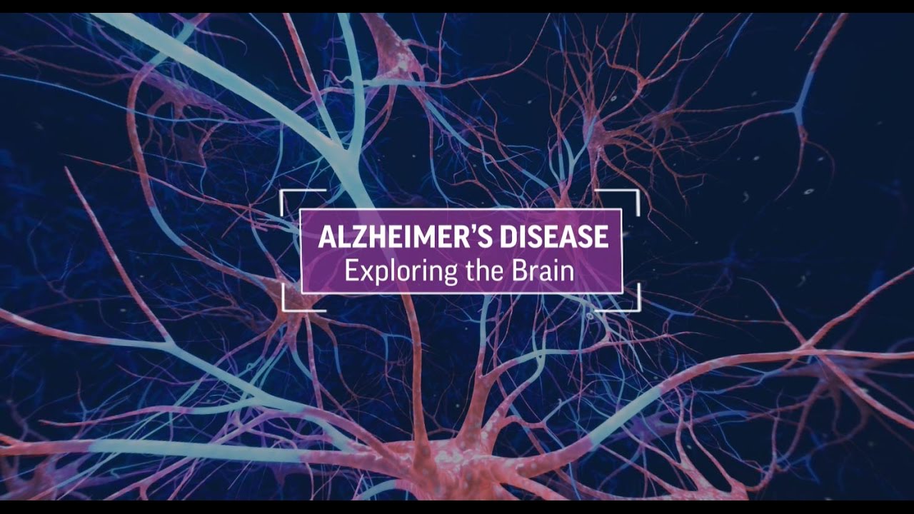 Alzheimer's Disease: Exploring The Brain - YouTube