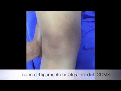 Lesión Del Ligamento Colateral Medial De La Rodilla - YouTube