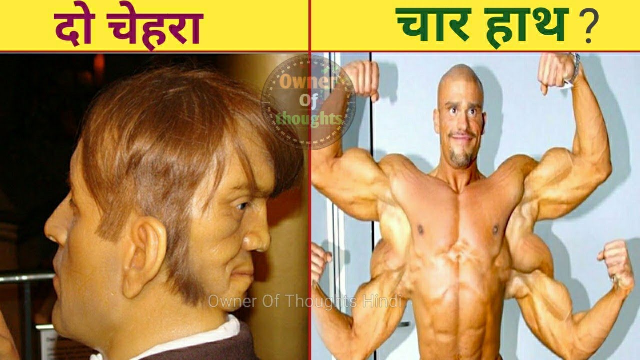 ऐसे लोग जिन्हें भगवान ने सबसे अलग बनाया | 5 Unusual People Born With ...