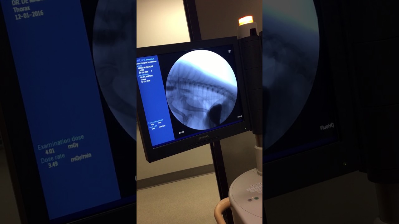 Esophageal Fluoroscopy - YouTube