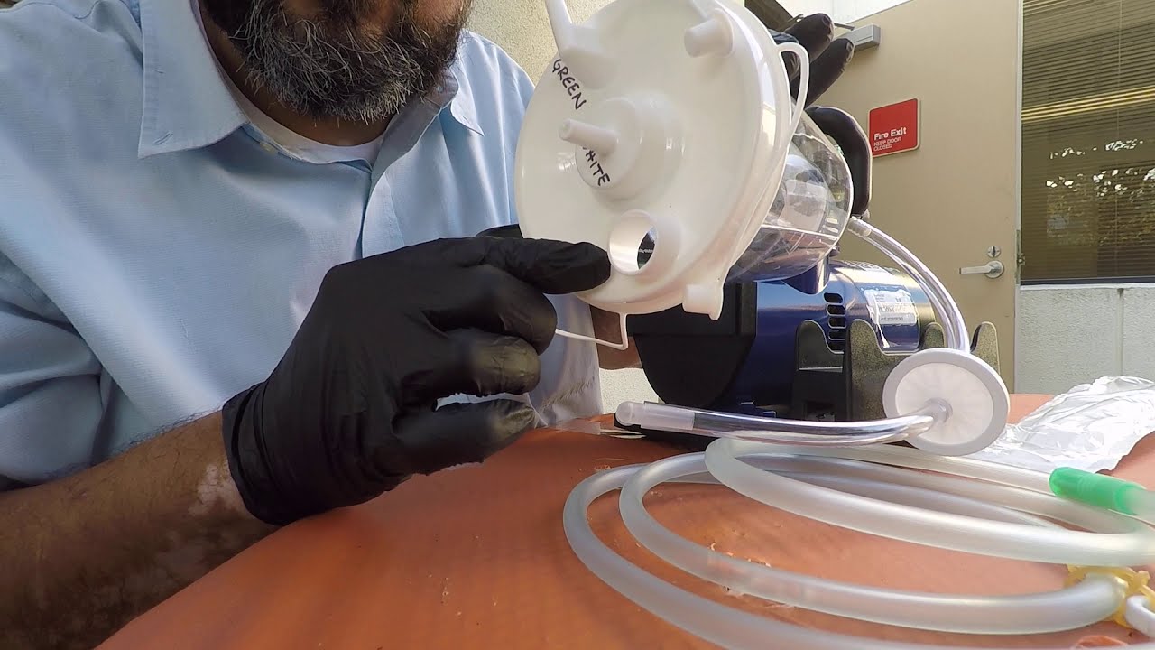 Aspirator (Suction) Setup Guide - YouTube