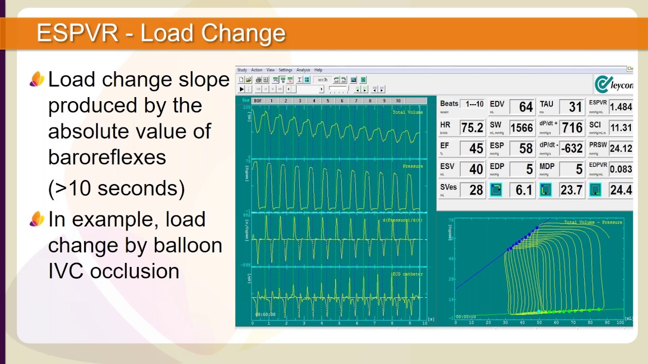 PV Loops in HFpEF Evaluation - YouTube