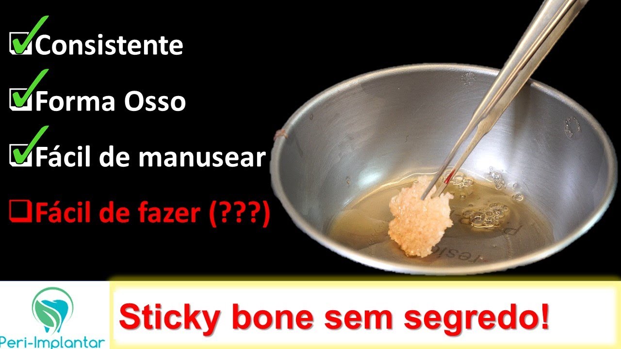 Dominando o Sticky bone - YouTube