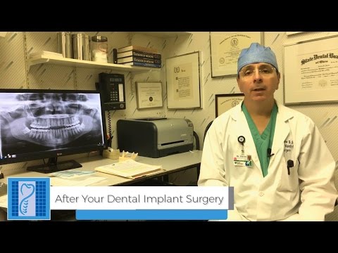 How Long To Use Peridex After Dental Implant