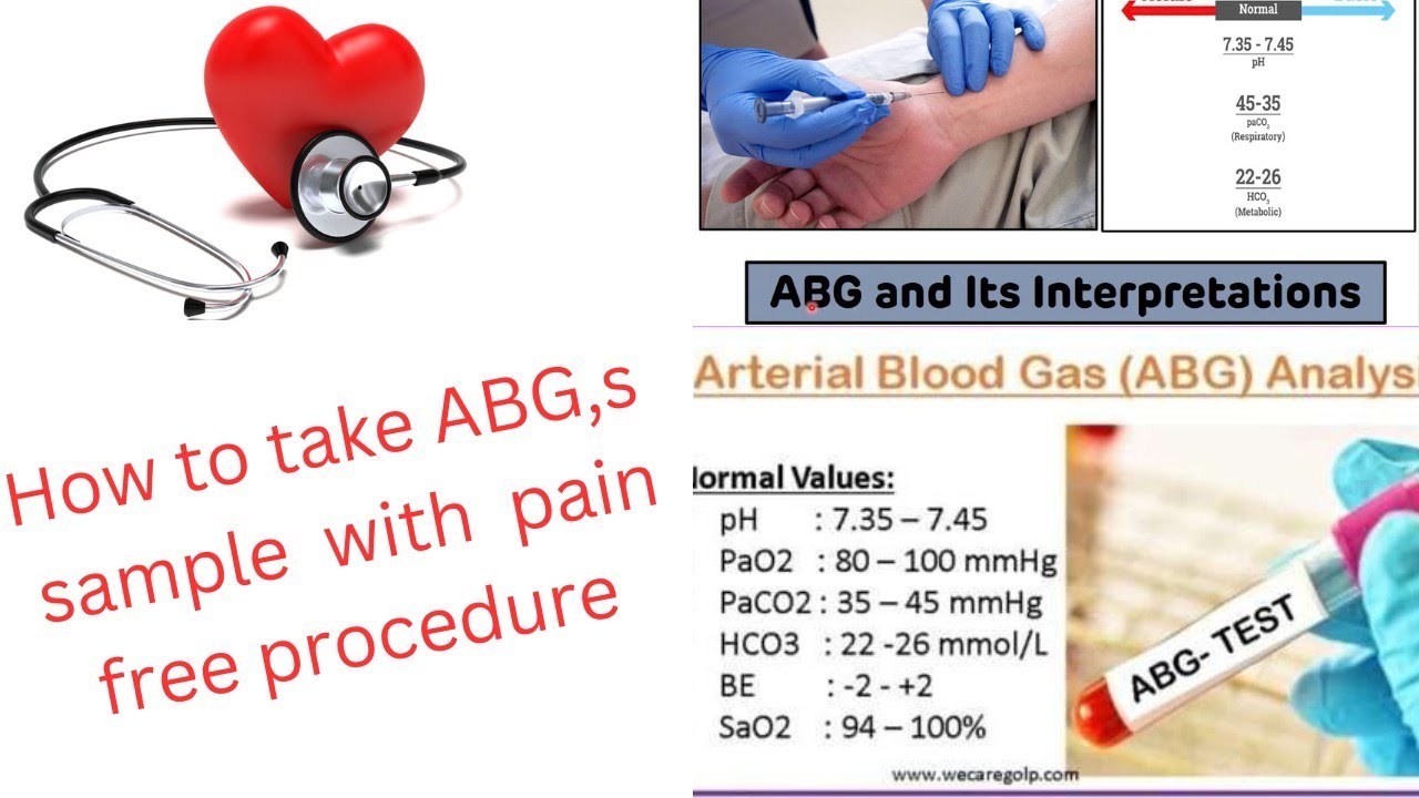 ABG,s Interpretation||How to take ABG,s sample with pain free procedure ...