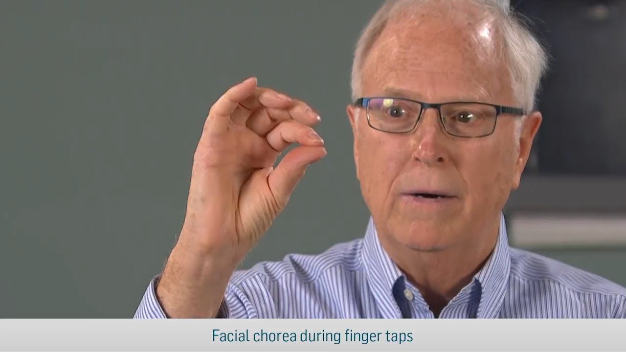 Impact of HD Chorea: Examples of Movement - YouTube