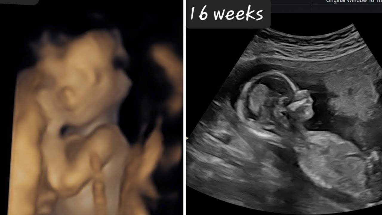 16 weeks baby bonding gender reveal ultrasound scan! 🤌🌟💙💓 - YouTube