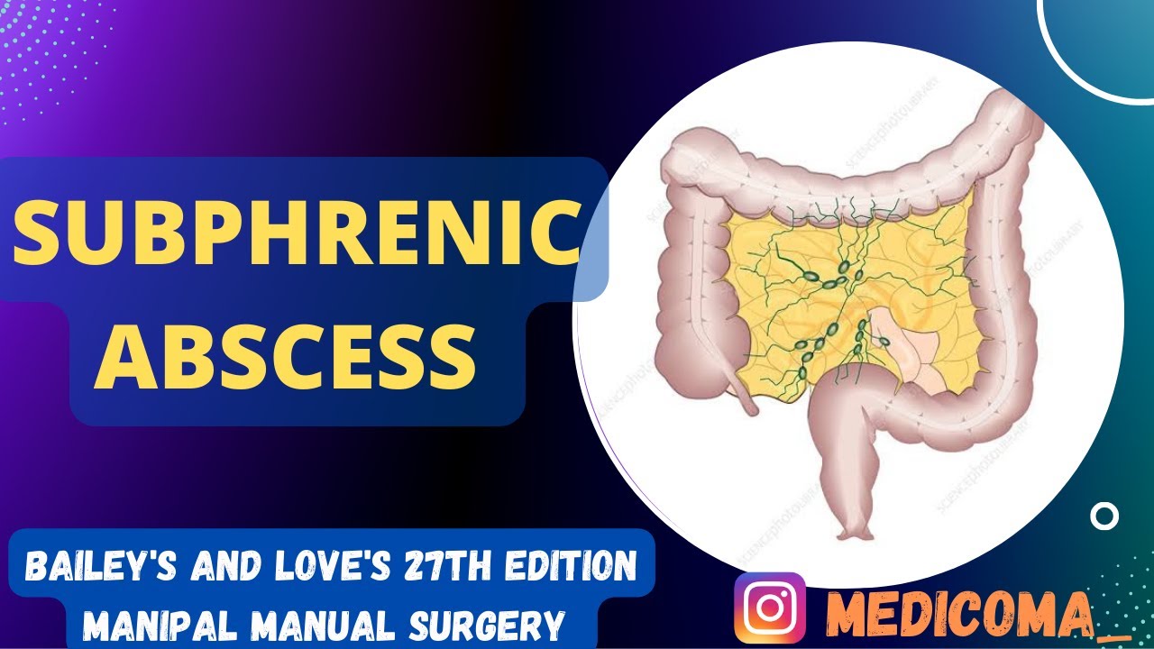 SUBPHRENIC ABSCESS || ETIOLOGY, PATHOPHYSIOLOGY, CLINICAL FEATURES ...
