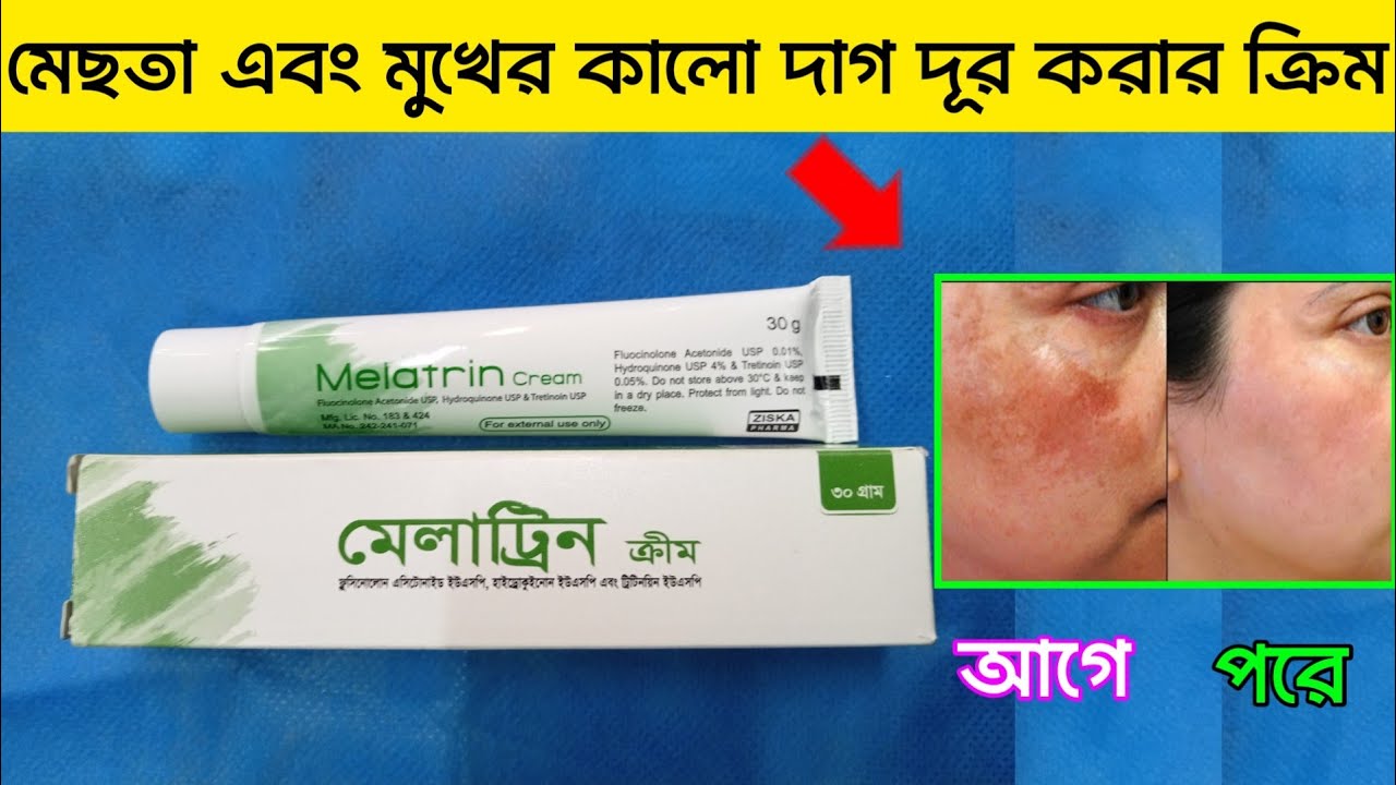 মেলাট্টিন ক্রিম ব্যবহার | Melatrin Cream Uses | মেছতা এবং মুখের কালো ...