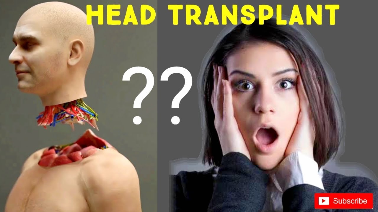 Head Transplantation: The Ultimate Medical Challenge by Brainbridge ...