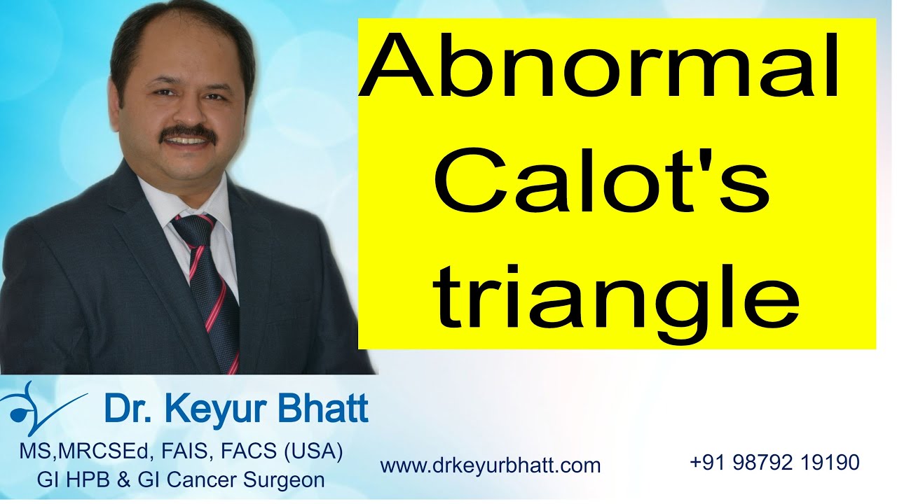 Laparoscopic cholecystectomy | Gall Bladder Stone | Abnormal Calot's ...