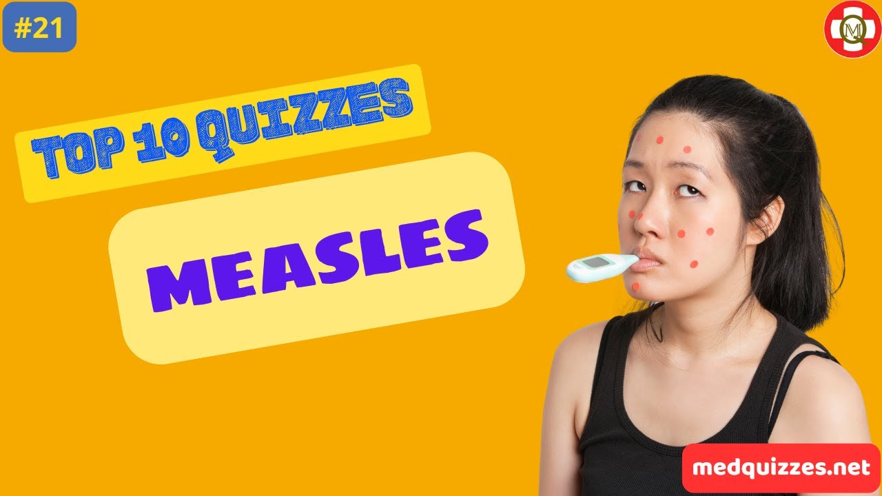 #21. Top 10 Quizzes About Measles: Test Your Knowledge! - YouTube