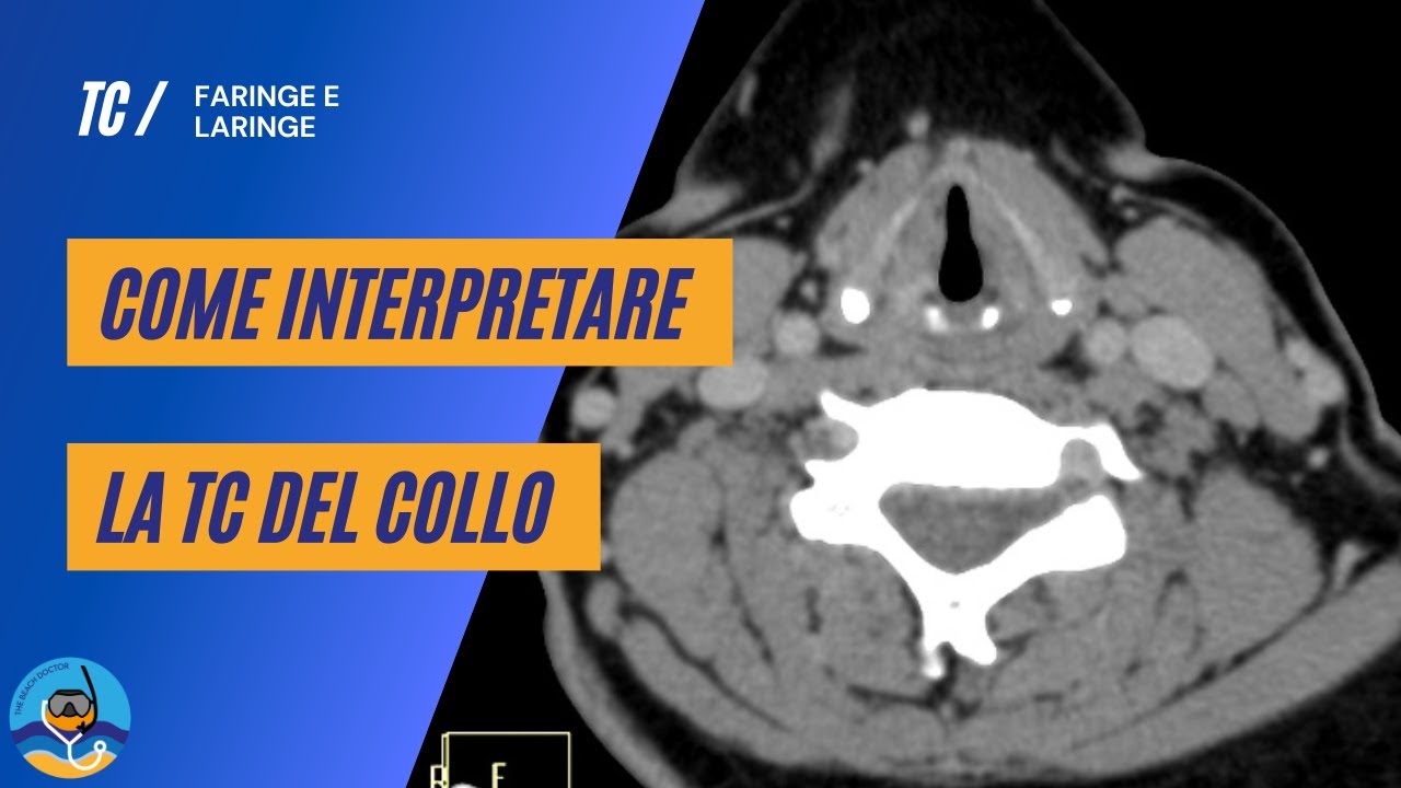 Come interpretare la TC del collo - YouTube