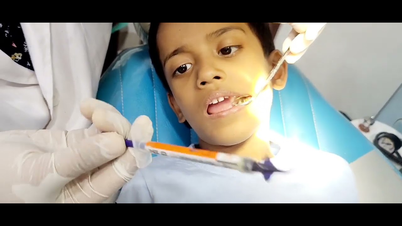 Root Canal Treatment in kids tooth देखिए live video || @rootcanaltre ...