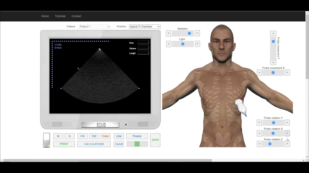 Apical 3 Chamber View - YouTube