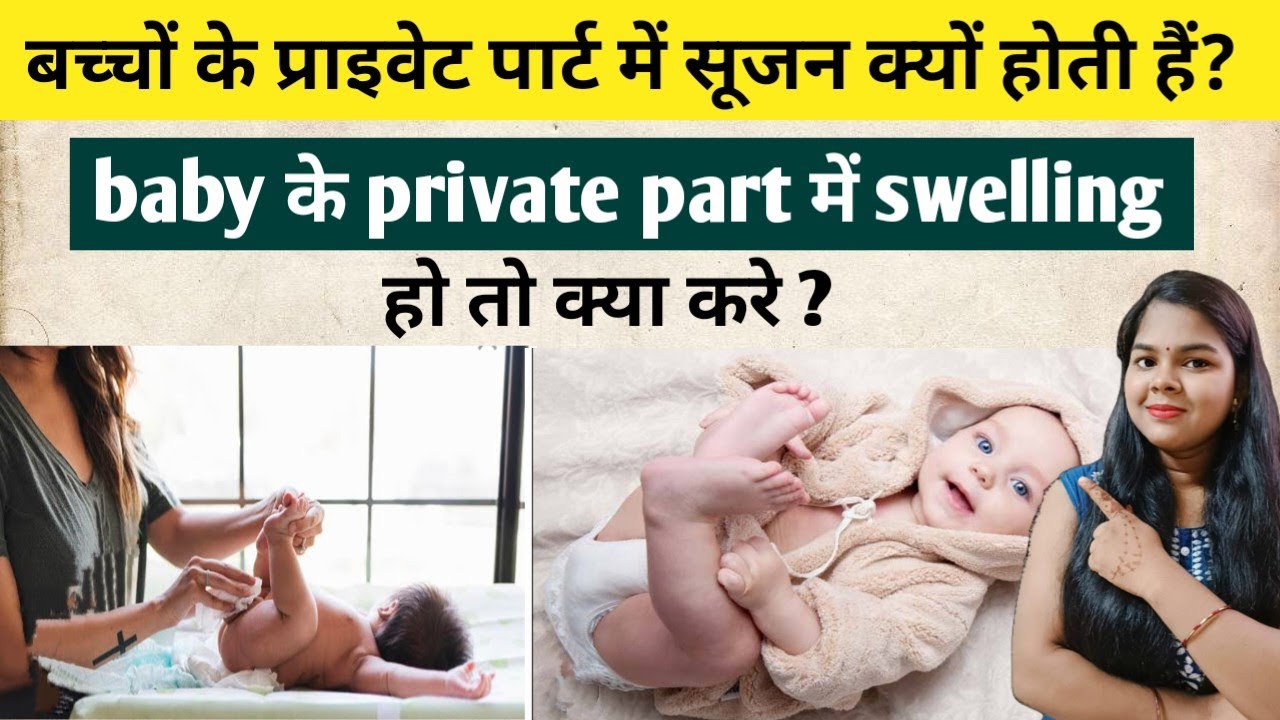 बच्चों के प्राइवेट पार्ट में सूजन क्यों होता है? baby ke private part ...