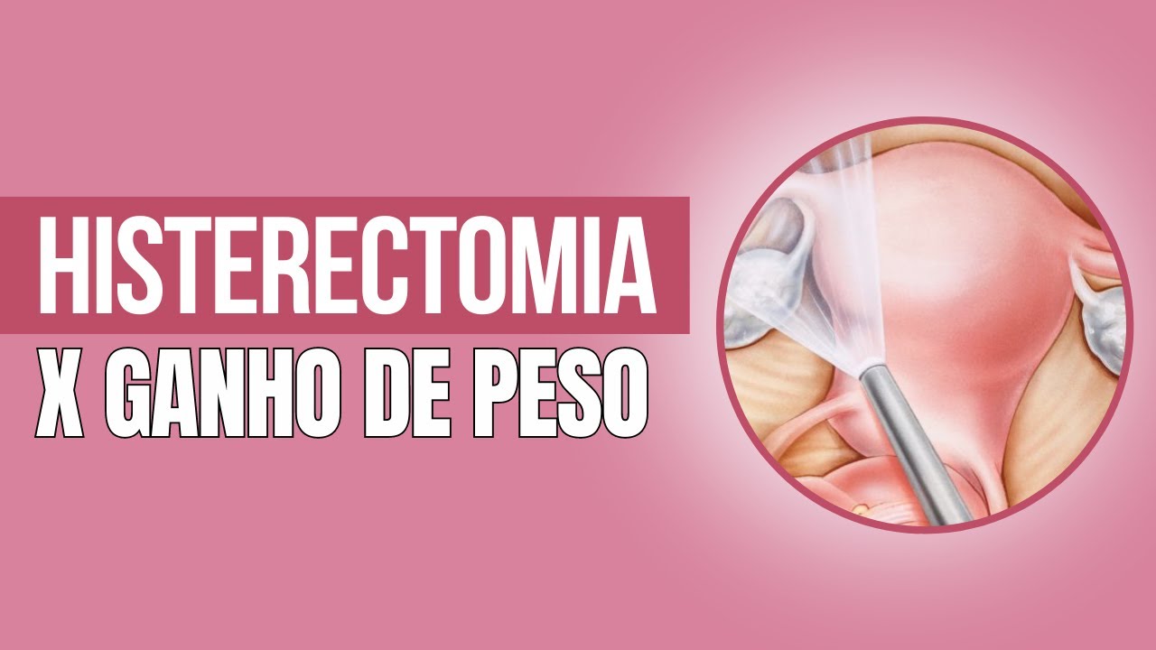 Peso Na Barriga Após Histerectomia Retoedu