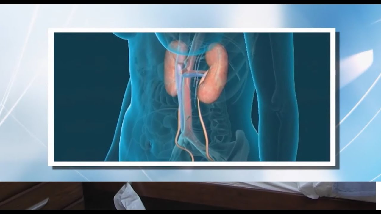 CentraCare Urology - Urinary Incontinence Surgery For Females - YouTube