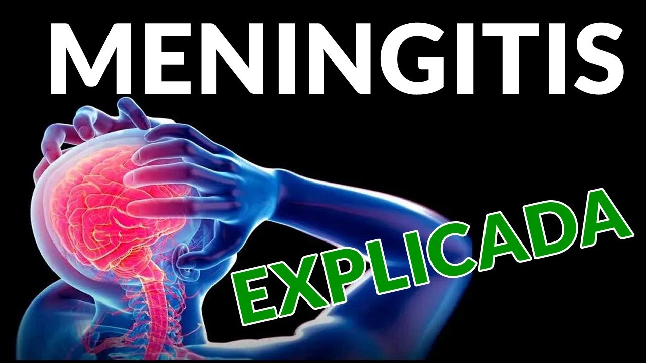 Meningitis explicada: Causas, tipos, síntomas y tratamientos. - YouTube