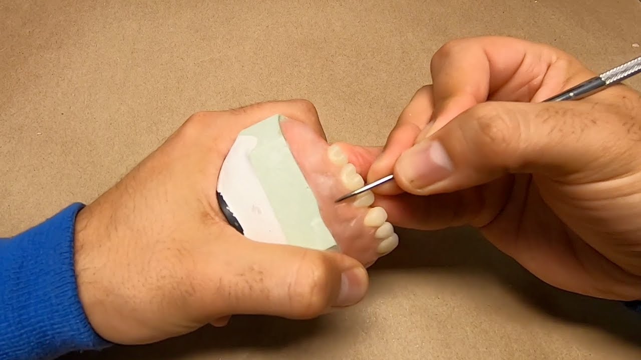 Waxing and Contouring Denture Bases - YouTube