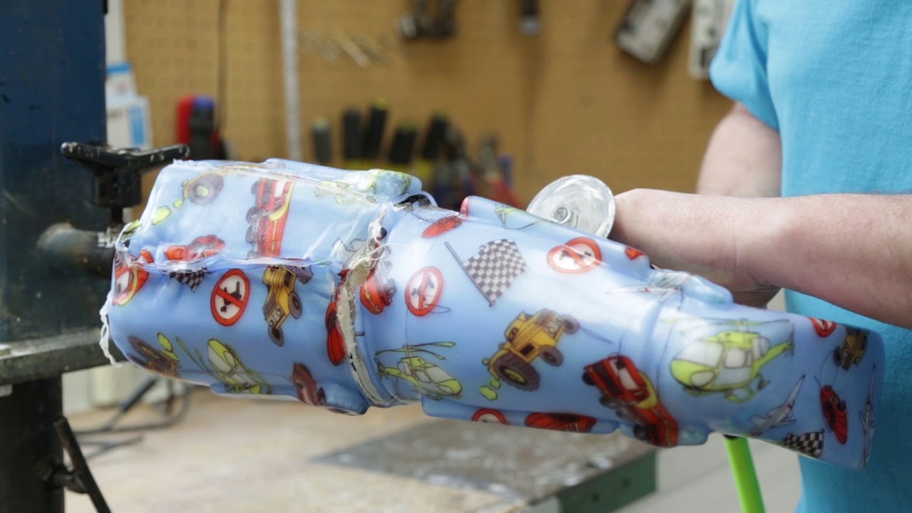 Custom Made Braces - YouTube