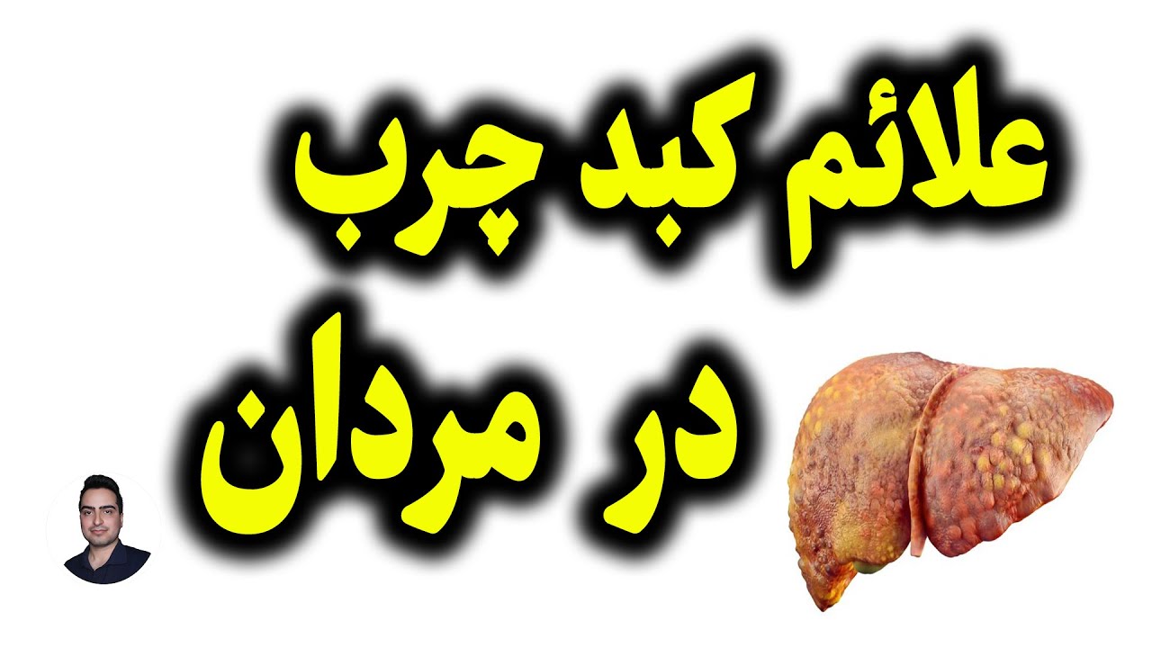 علائم کبد چرب در مردان چیست Youtube