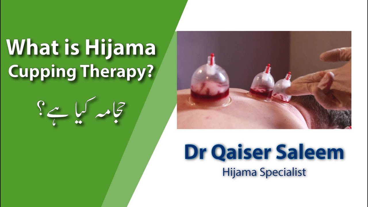 Cupping Therapy (Hijama) Part-2 - YouTube