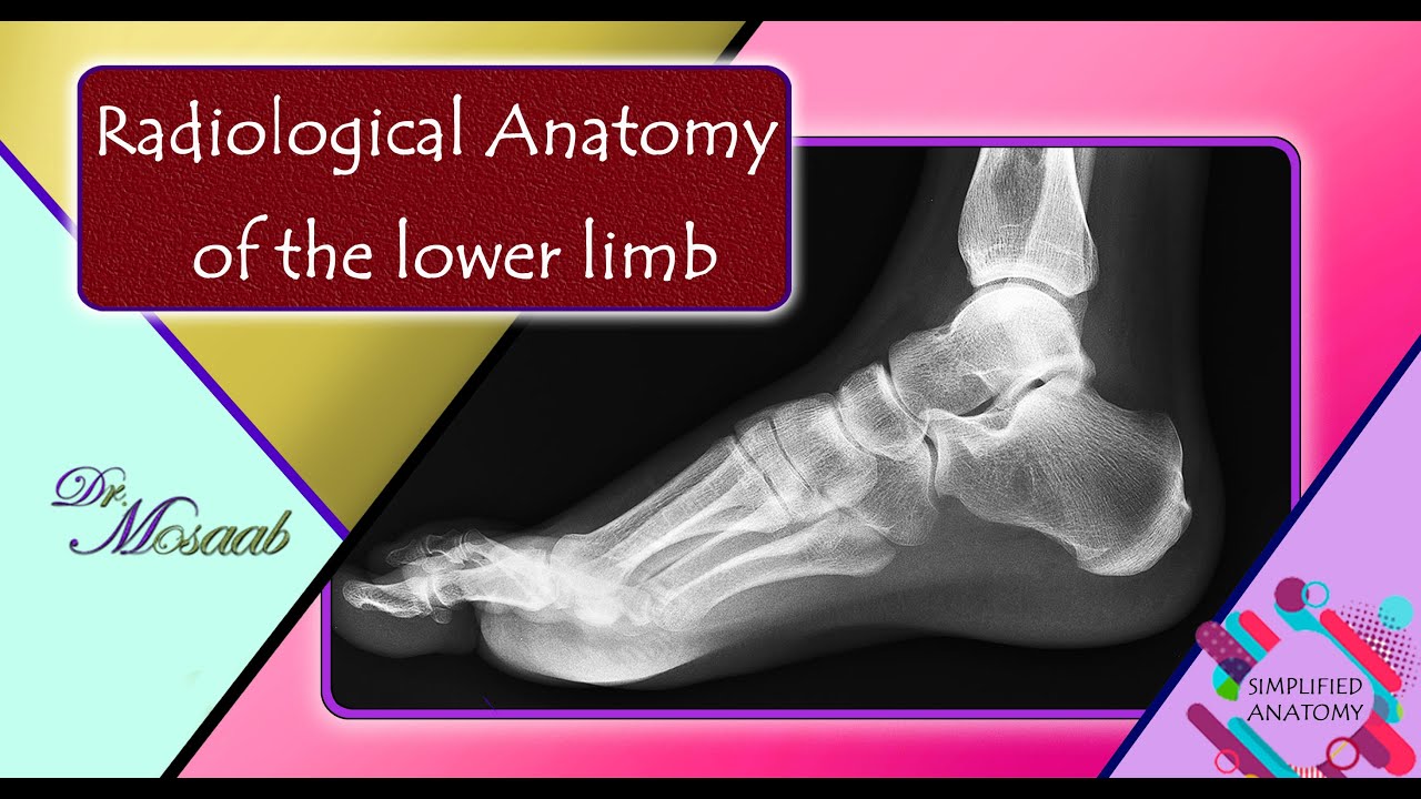Radiological anatomy (X-ray) of the lower limb - YouTube