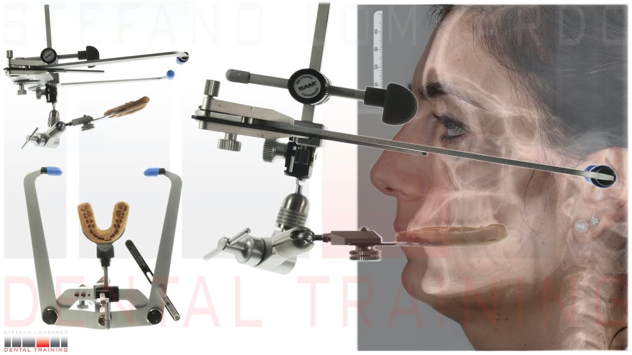 Digital & Analog Registration: deprogrammer JIG & Facebow - YouTube