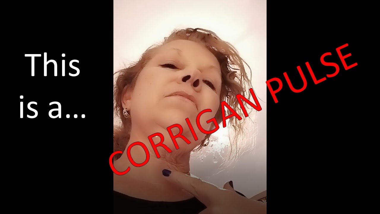 SHOWING YOU MY CORRIGAN PULSE AND CUTTING MY BRACELETS - YouTube