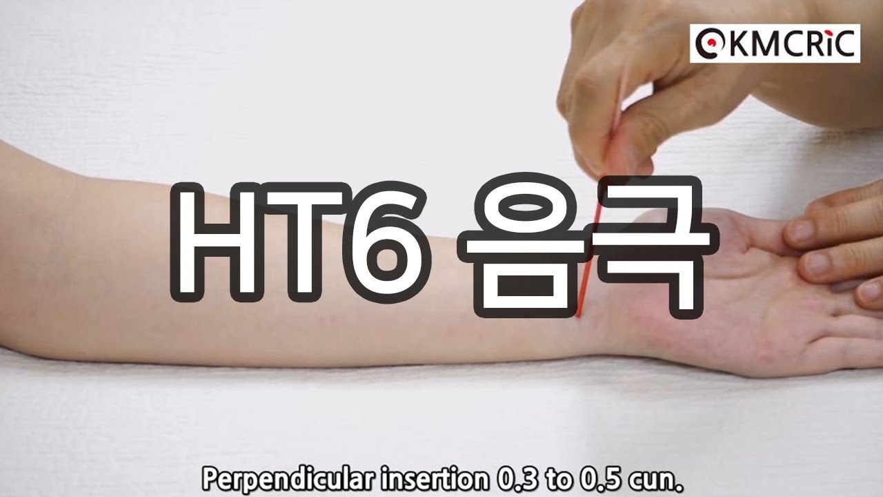 HT6 음극 陰郄 Yinxi (Eng sub) - KMCRIC WHO Standard acupoint DB - YouTube