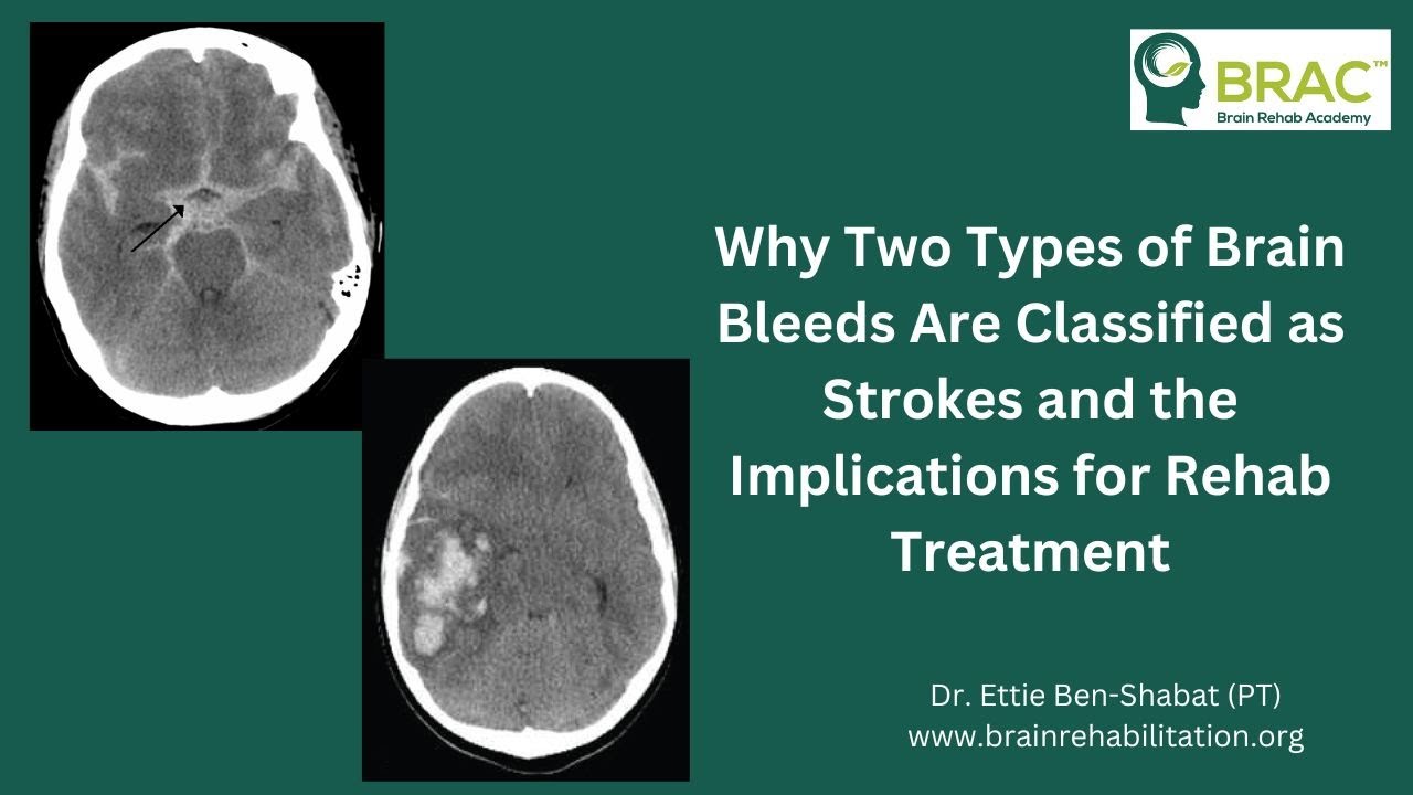 Why Two Types of Brain Bleeds Are Classified as Strokes and the ...