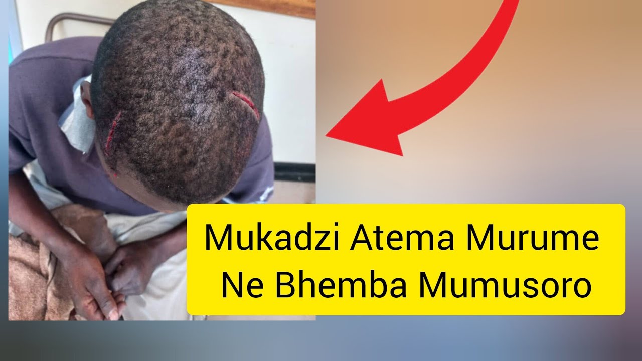 Mukadzi Atema Murume Nebhemba Mumusoro - YouTube