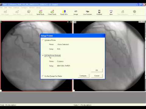 TIMS Dicom Converter Demo - YouTube