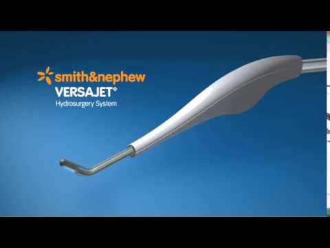 Sistema de hidrocirugía Versajet - Medifacil - YouTube