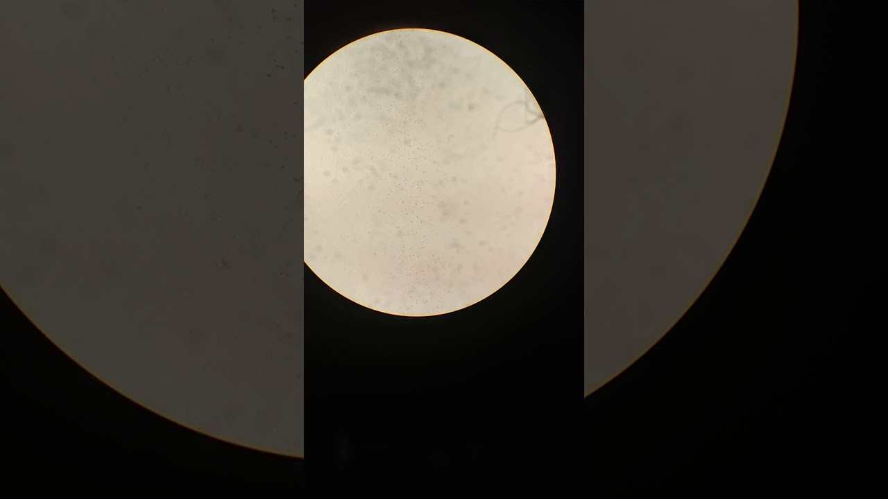 Motility of bacteria by hanging drop method - YouTube