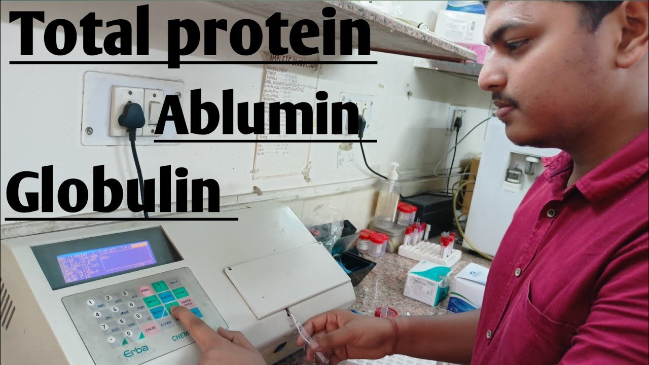 Total protein, Albumin, Globulin || liver function test || in semi ...