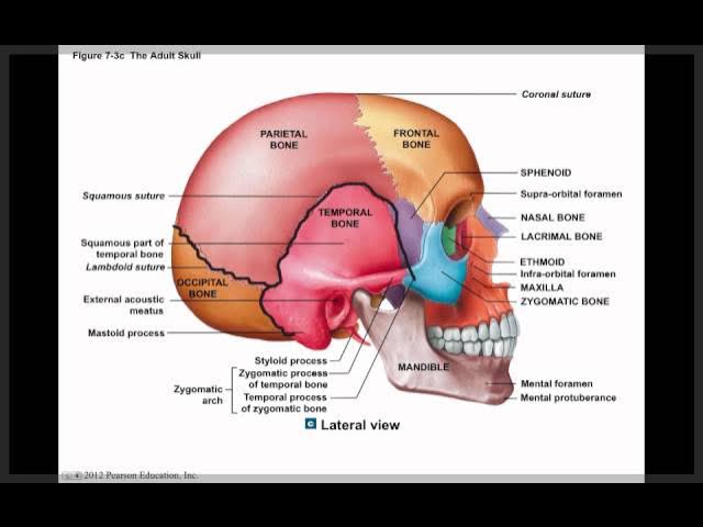 Skull Diagram Anterior View With Labels Part 1 Axial Sk