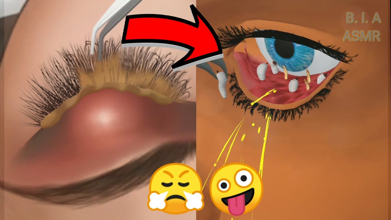 ASMR Old Woman Makeup Tutorial Animation #maggot #treatment - YouTube