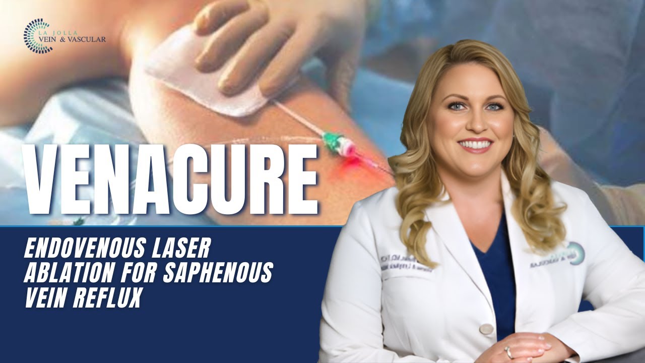 VenaCure: Endovenous Laser Ablation for Saphenous Vein Reflux | Quick ...