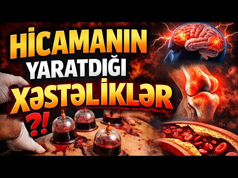 Hicama hansı xəstəliklərdə istifadə olunur? Zərərləri nələrdir? #hicama