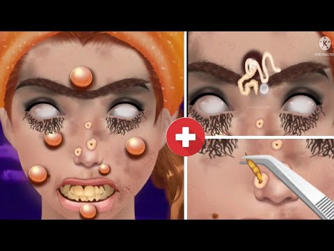 Transform Skin: Face Treatment Secrets Revealed! - YouTube