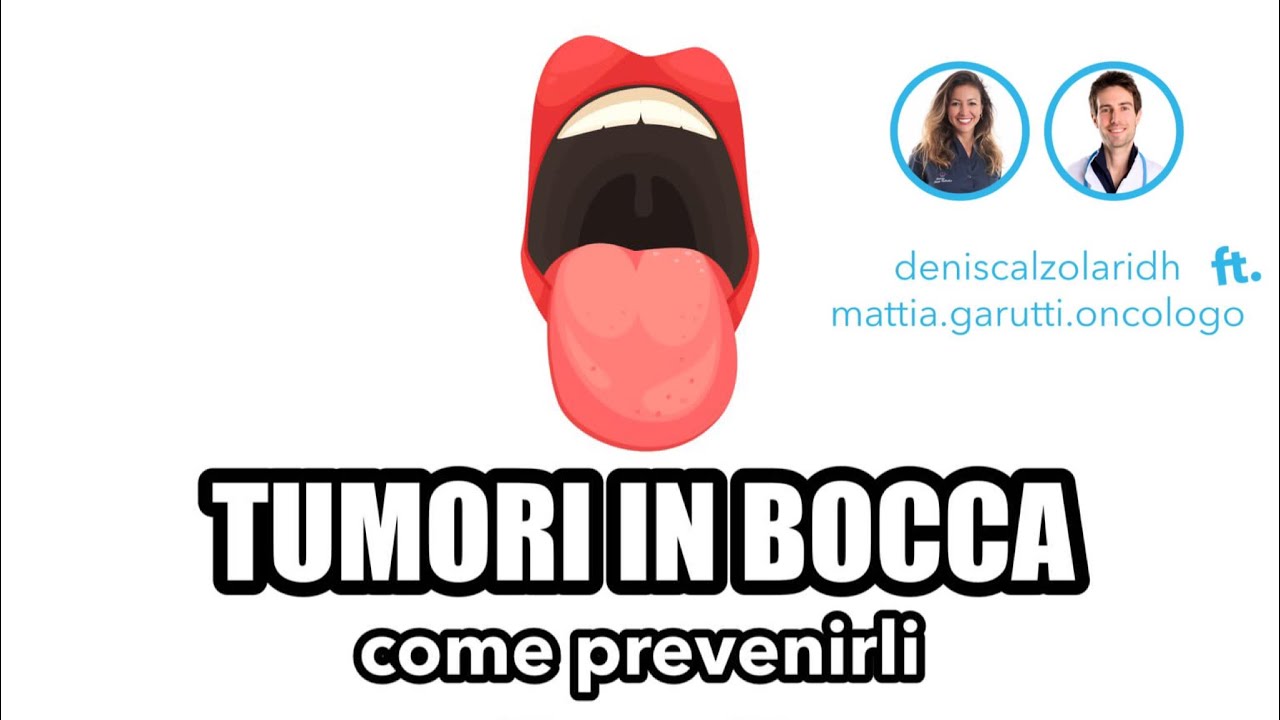 Tumori in bocca. Come prevenirli (Dr. Mattia Garutti) - YouTube