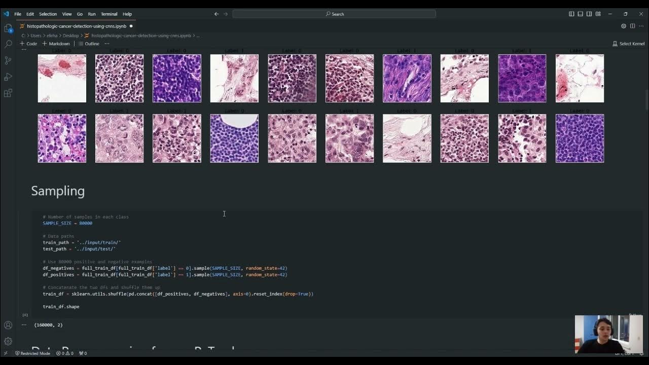 Deep Learning Histopathologic Cancer Detection (GRUP-30) - YouTube