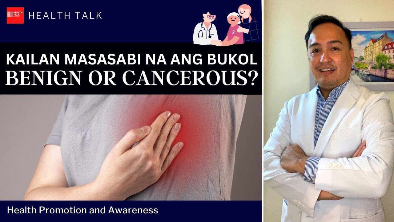 Kailan masasabi na ang bukol ay benign or cancerous? - YouTube